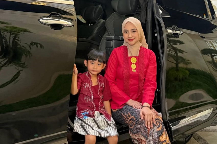Ria Ricis Tampil Lebih Tirus dan Mancung, Netizen: Ini Oplas atau Efek ...